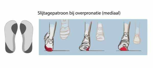 Slijtagepatroon op schoenen - Wat betekenen het? - Skystep