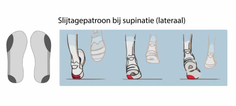 Slijtagepatroon op schoenen - Wat betekenen het? - Skystep