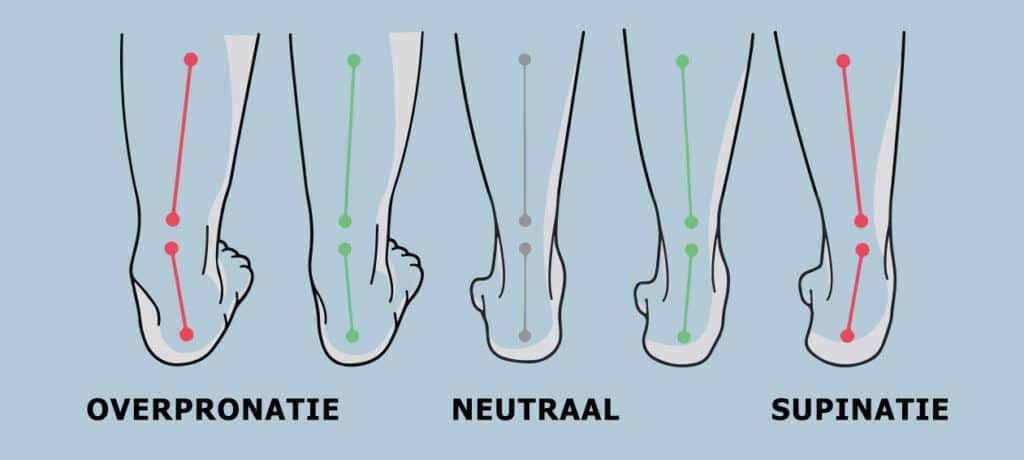 Slijtagepatroon op schoenen - Wat betekenen het? - Skystep