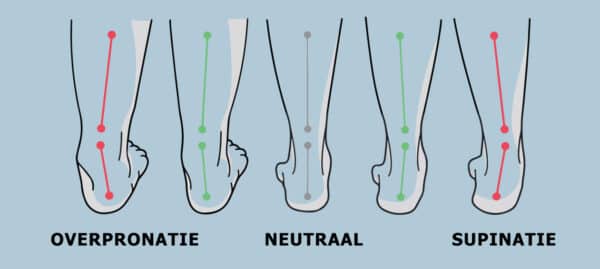 Slijtagepatroon op schoenen - Wat betekenen het? - Skystep