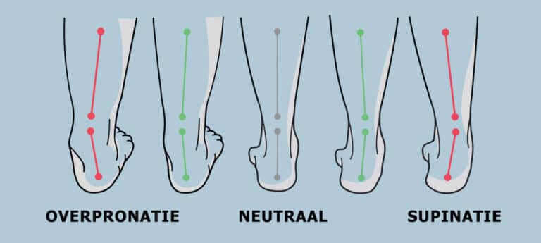 Slijtagepatroon op schoenen - Wat betekenen het? - Skystep